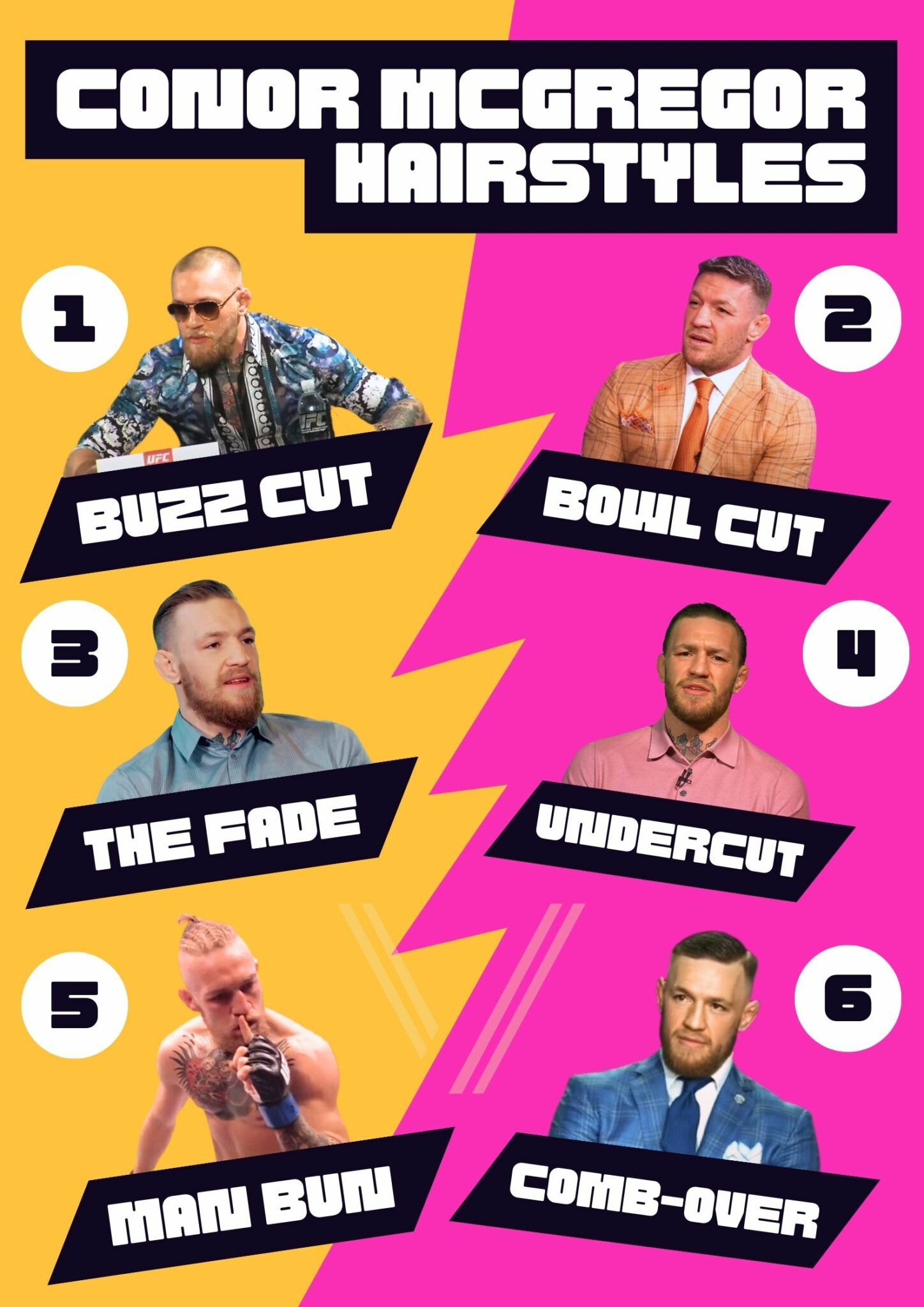Conor McGregor Hair Transplant: Before and After Transformation