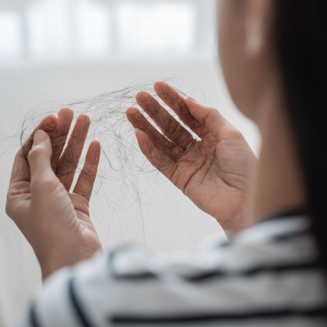 PCOS Hair Loss: Causes and Treatments | Vantage Hair