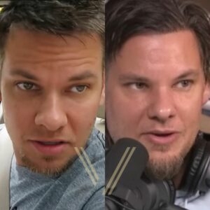 Theo Von Hair Transplant: Before and After Result