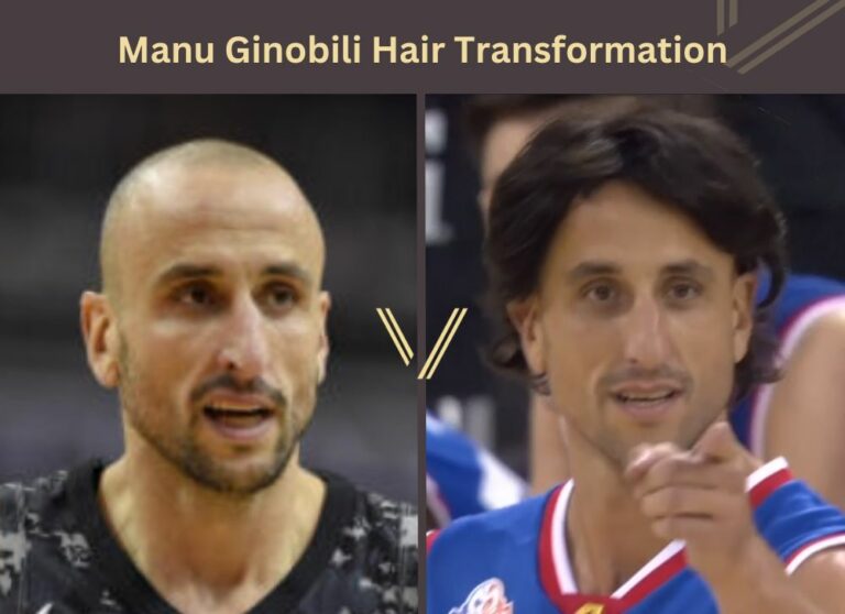 Basketball Players With Hair Transplants | Before and After Photos
