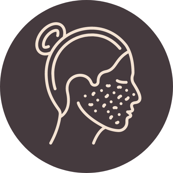 Top 5 Way to Fix Patchy Beard | Vantage Hair Clinic