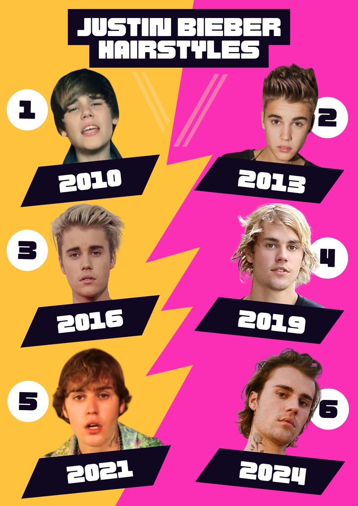 Justin Bieber Hair Transplant: Before and After Result