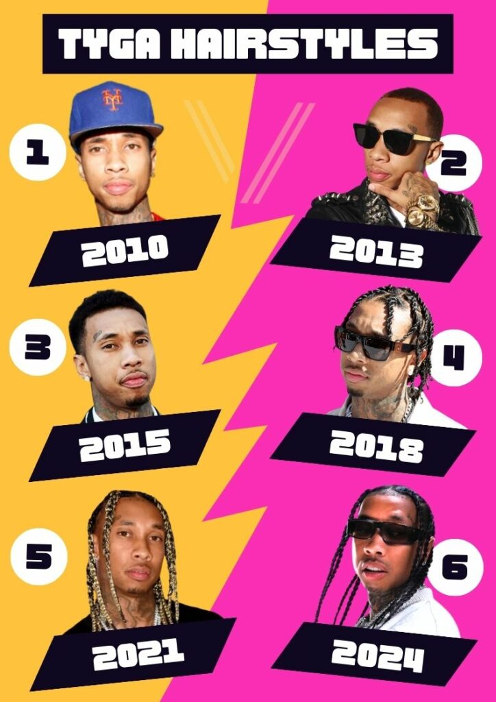 Tyga Hair Transplant: Before and After Result