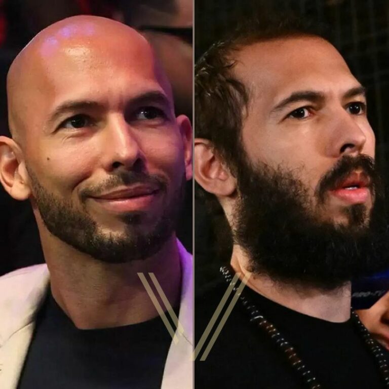 Andrew Tate Hair Transplant: Before and After Result