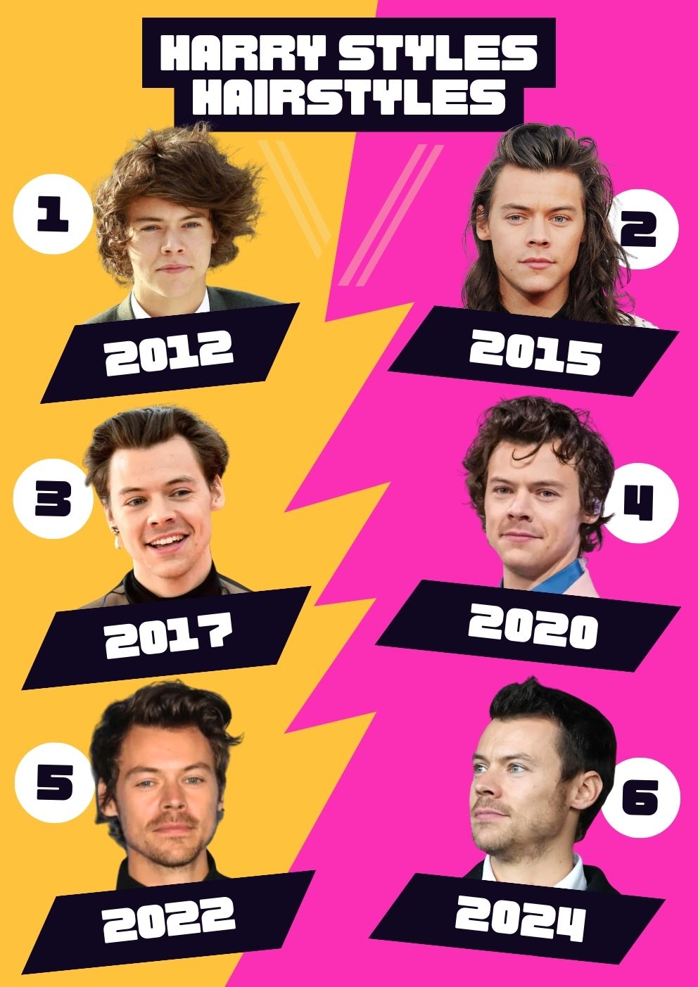 Harry Styles Hair Transplant: Before and After Result