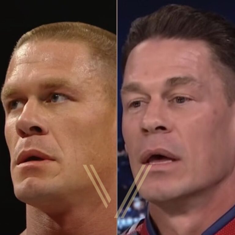 John Cena Hair Transplant: Before and After Result