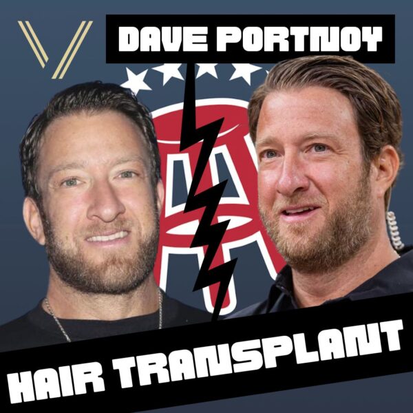 Dave Portnoy Hair Transplant
