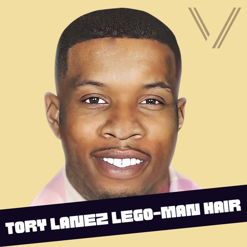 Tory Lanez Hair Transplant: Before and After Result