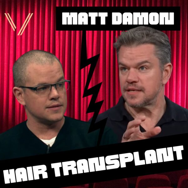 Matt Damon Hair Transplant: Before and After Result
