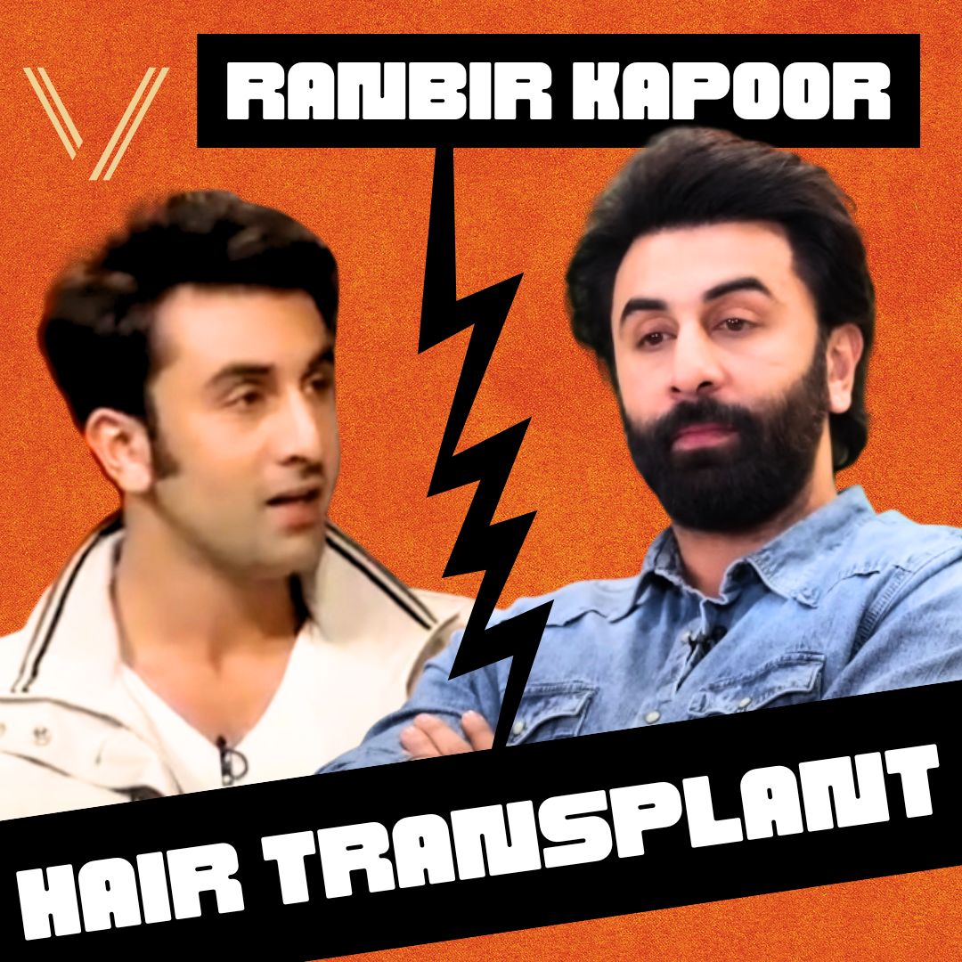 Ranbir Kapoor Hair Transplant: Before and After Result