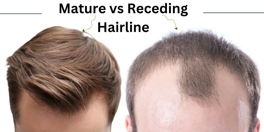 Mature Hairline - Complete Guide