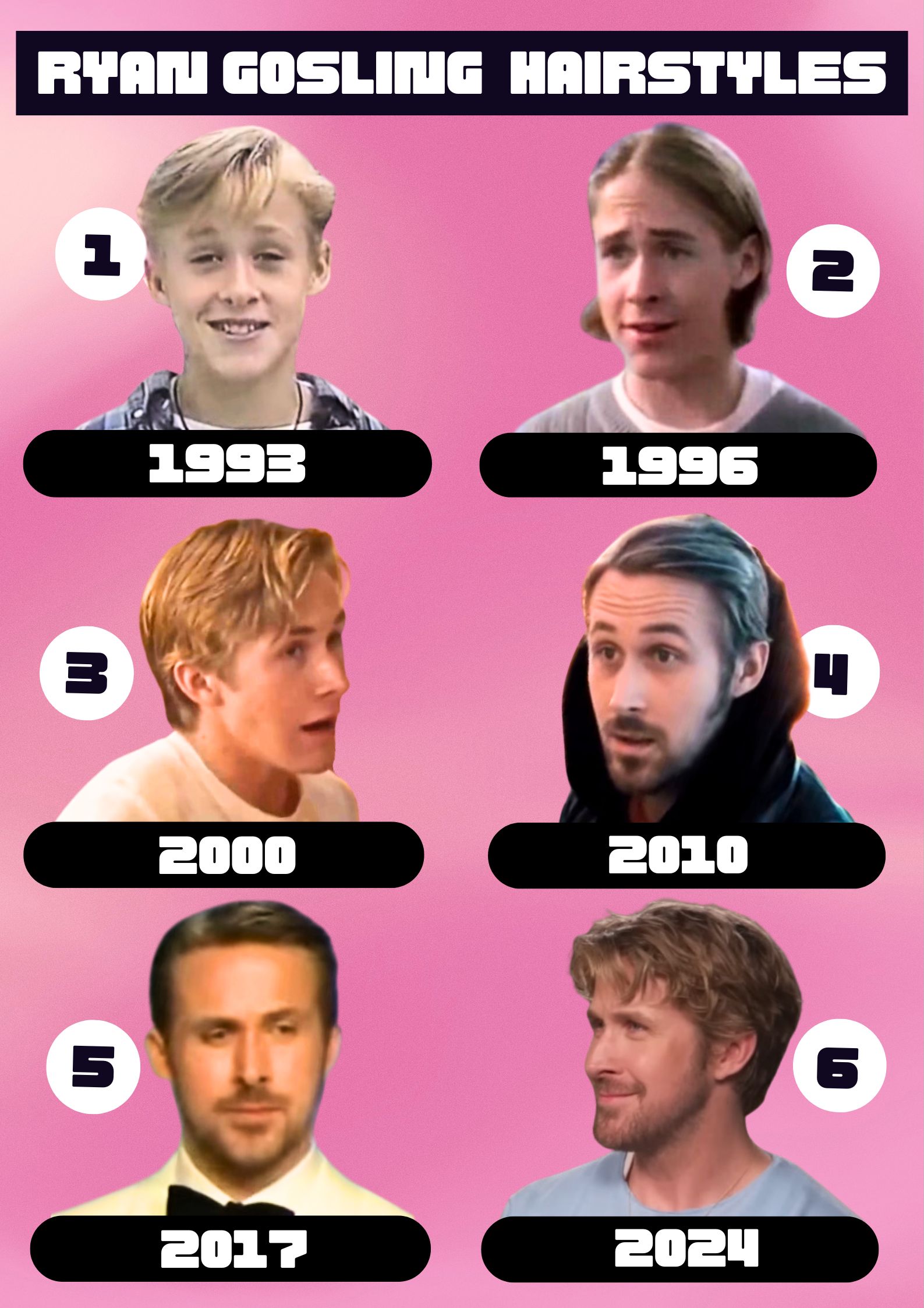 Ryan Gosling Hair Transplant - Before & After - Vantage Hair Clinic