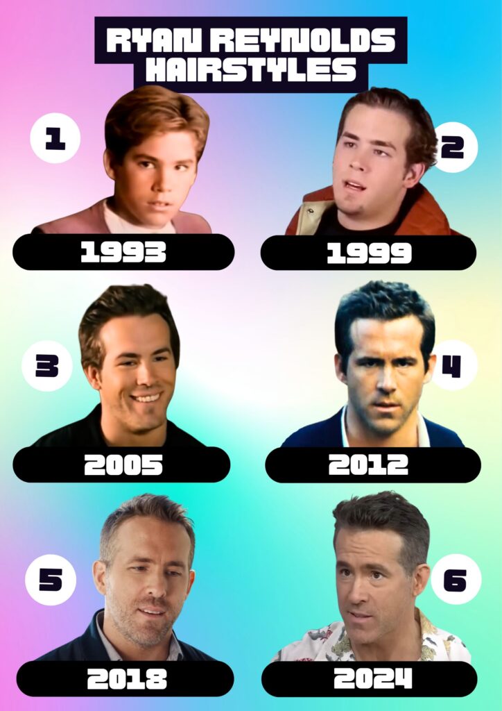 Ryan Reynolds Hair Transplant - Before After - Vantage Hair Clinic