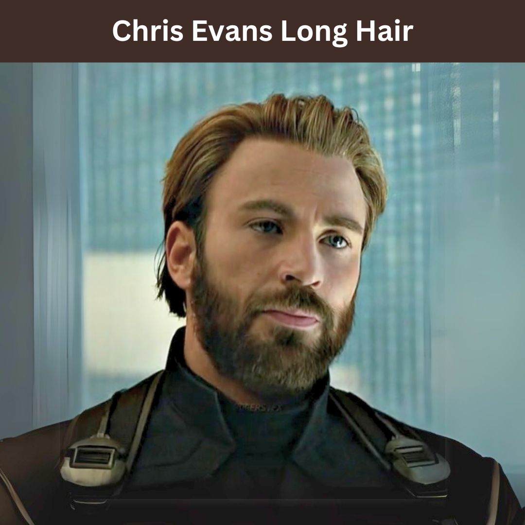 Chris Evans Hair Transplant - Before and After Result