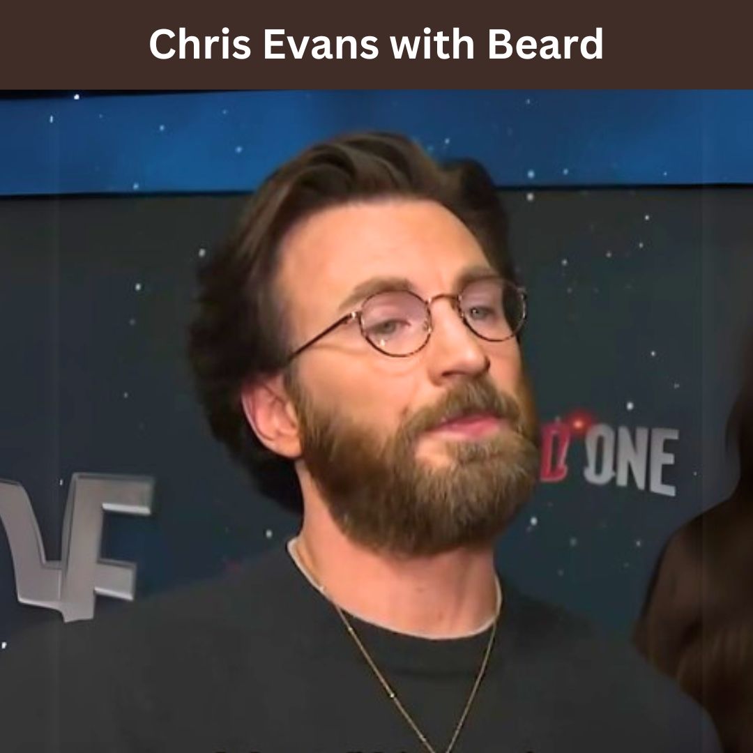 Chris Evans Hair Transplant Before And After Result