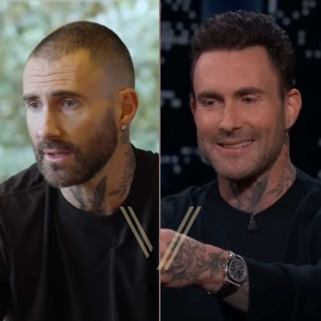 Adam Levine Hair Transplant: Before and After Transformation