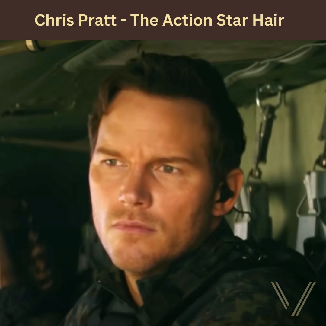 Chris Pratt Hair Transplant