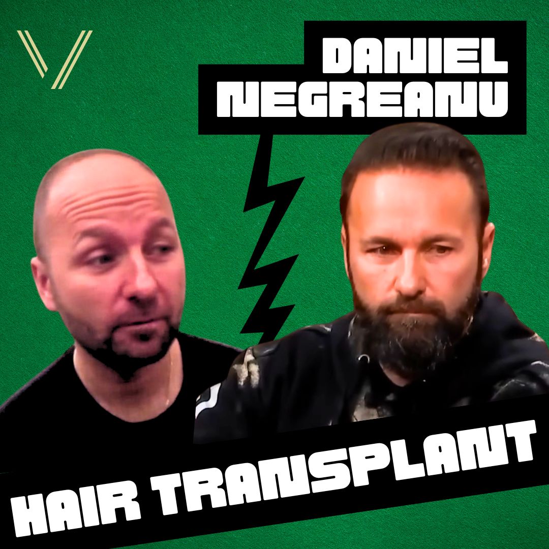 Rafa Marquez Hair Transplant