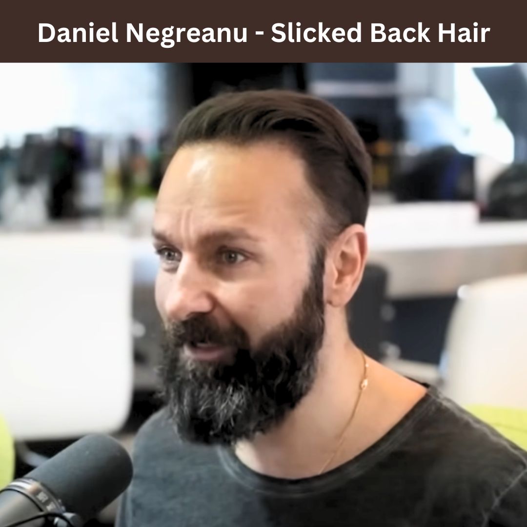 Daniel Negreanu Hair Transplant