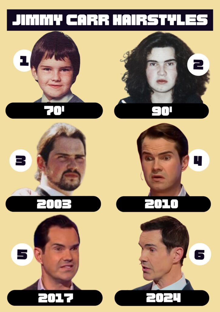 Jimmy Carr Hair Transplant: Before and After Transformation