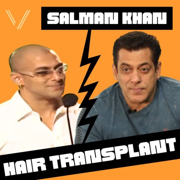 Salman Khan Hair Transplant: Before and After Transformation