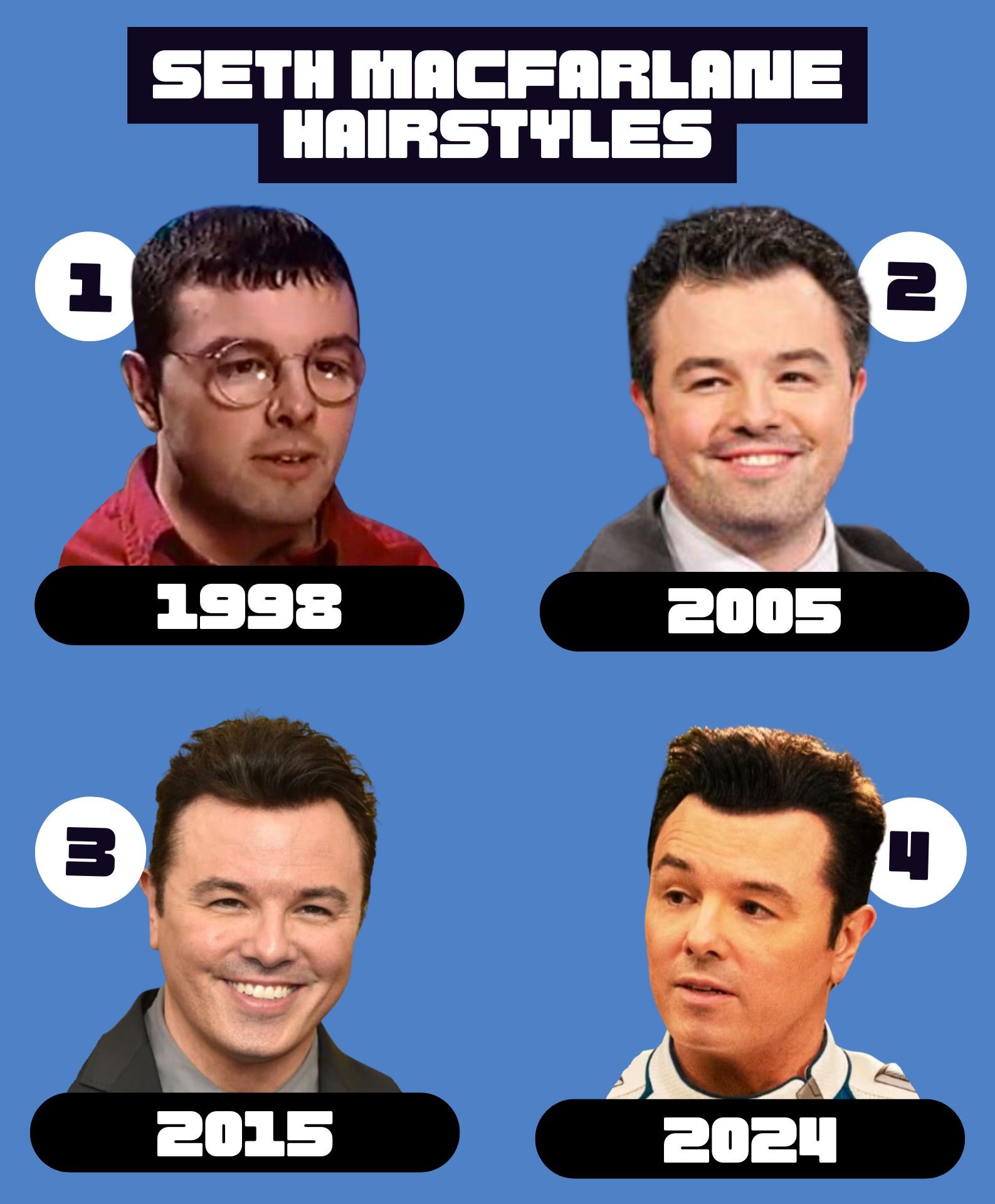 Seth MacFarlane Hair Transplant: Before and After Transformation