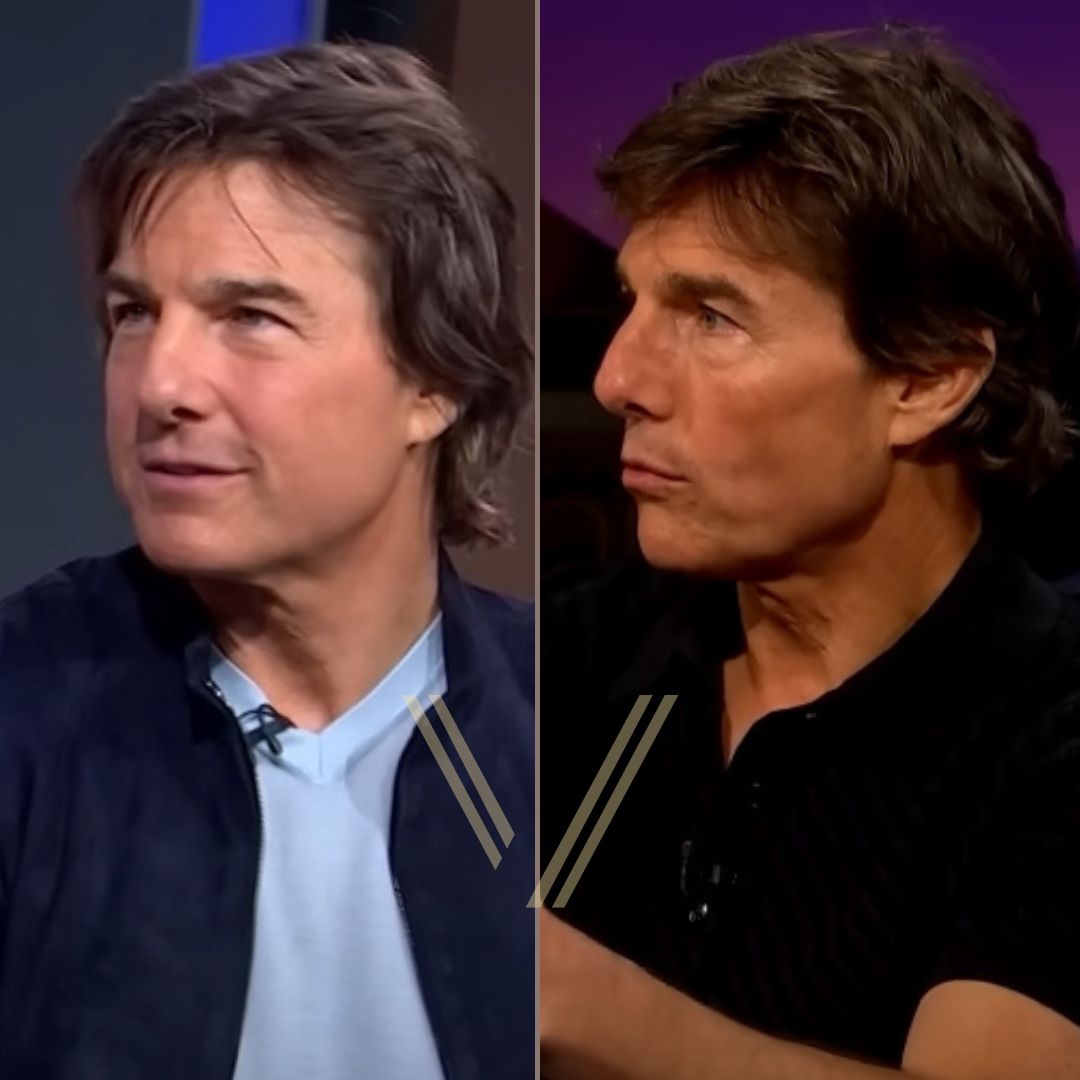 Tom Cruise Hair Transplant: Before and After Transformation