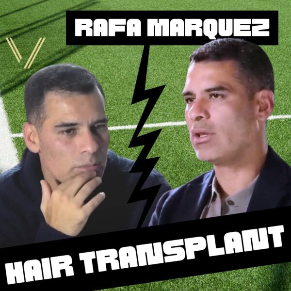 Rafa Marquez Hair Transplant