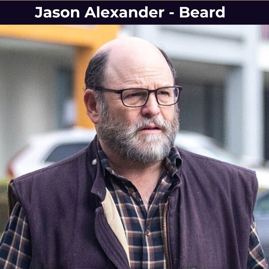 Jason Alexander Hair Transplant - Before and After