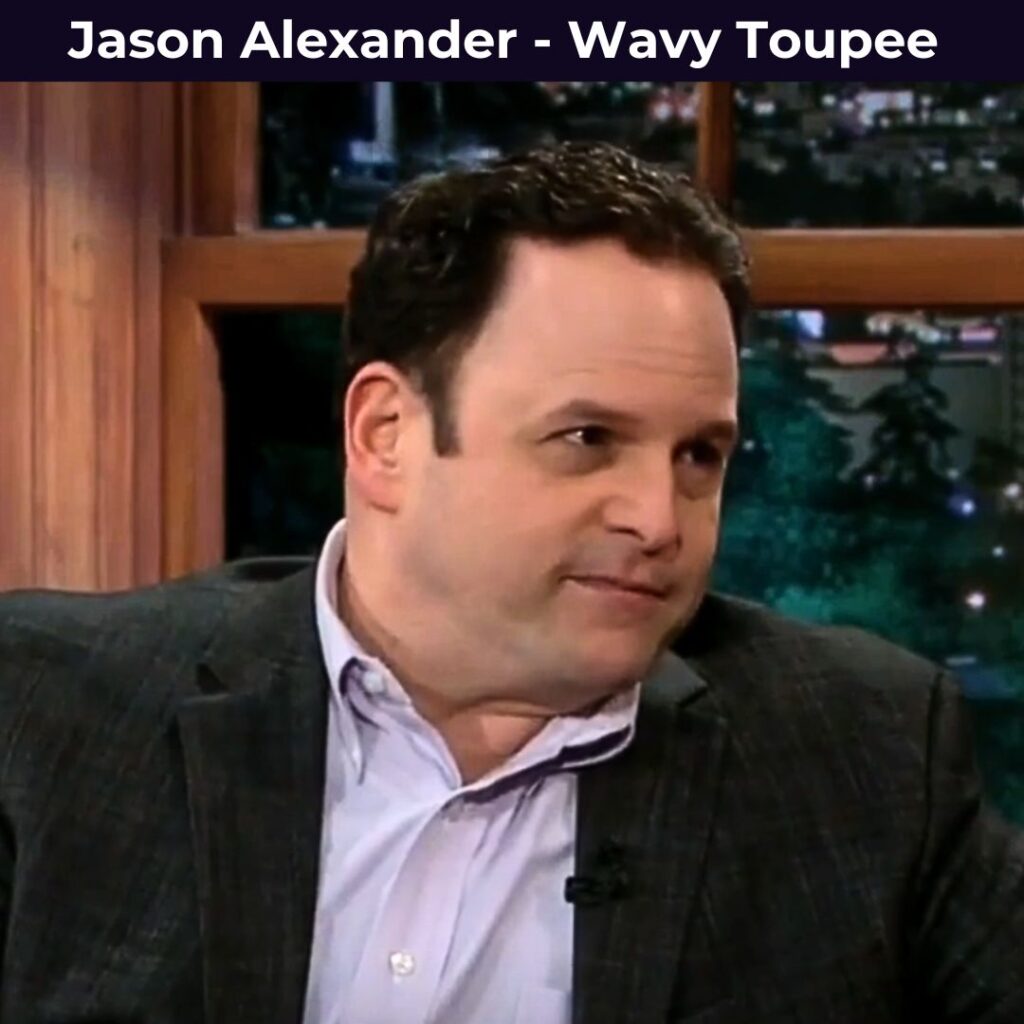 Jason Alexander Hair Transplant - Before and After