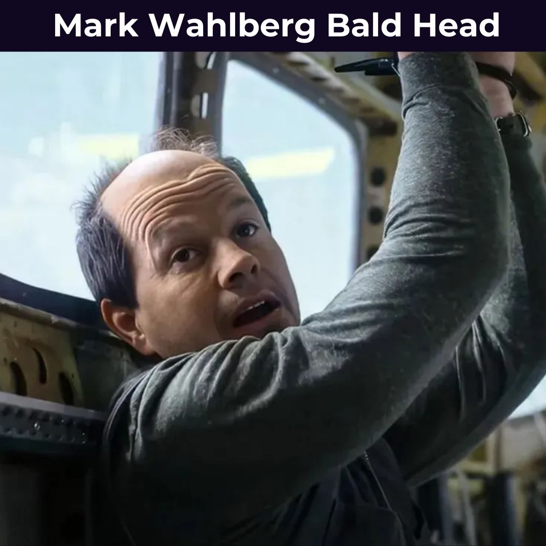 Mark Wahlberg Hair Transplant - Before and After