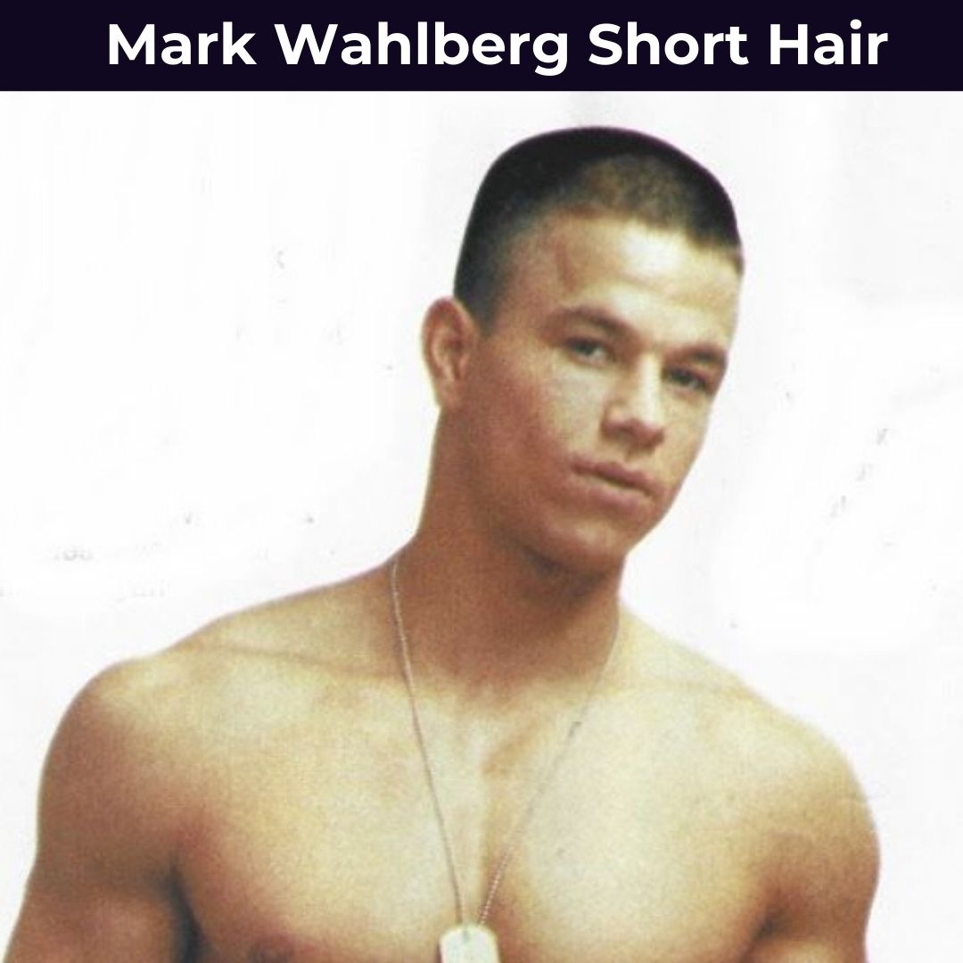 Mark Wahlberg Hair Transplant - Before and After