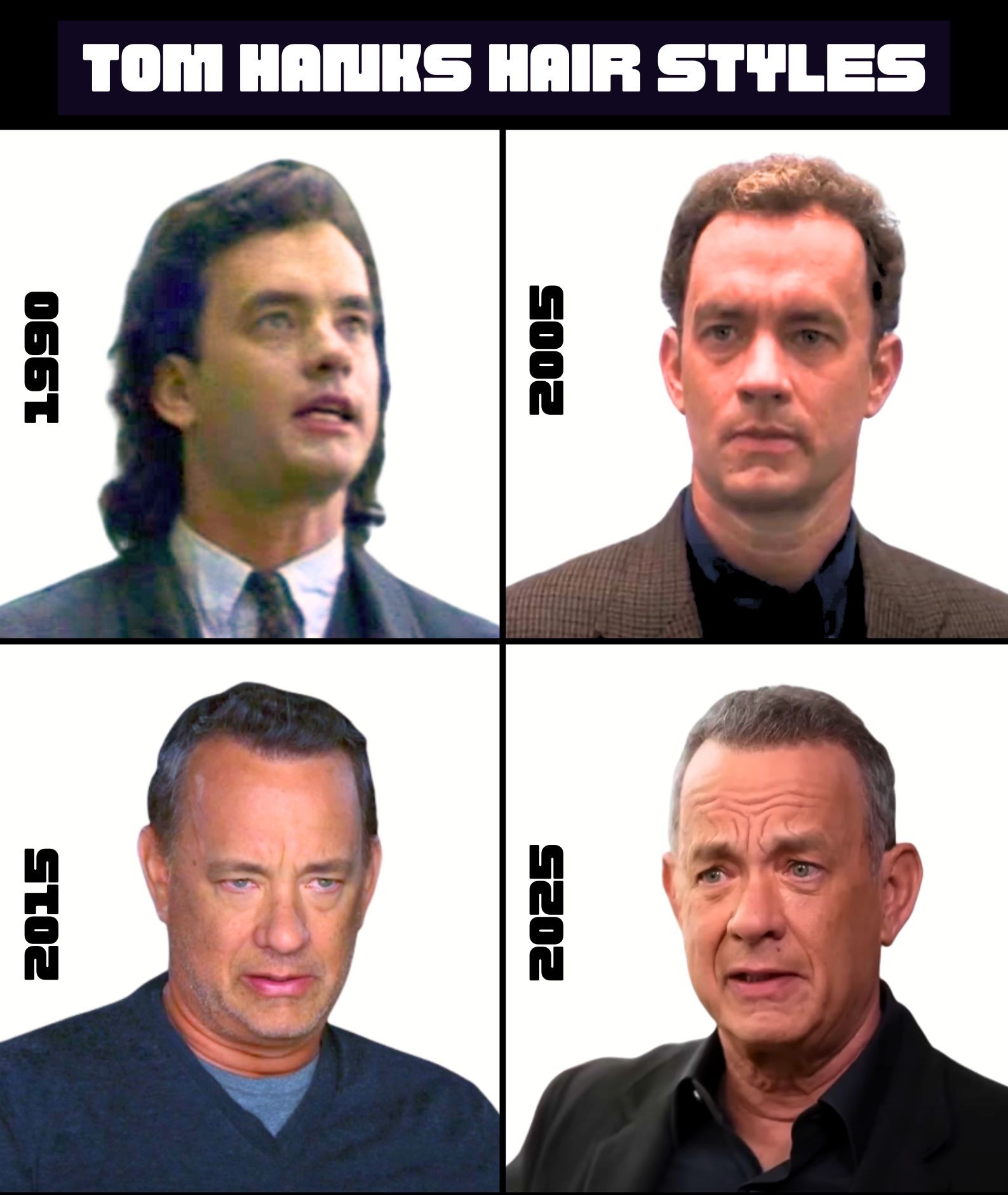 Tom Hanks Hair Transplant - Before and After